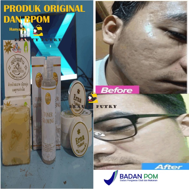Jual Paket 3in1 Ampuh mencerahkan wajah Toner erna Malaysia erna ...