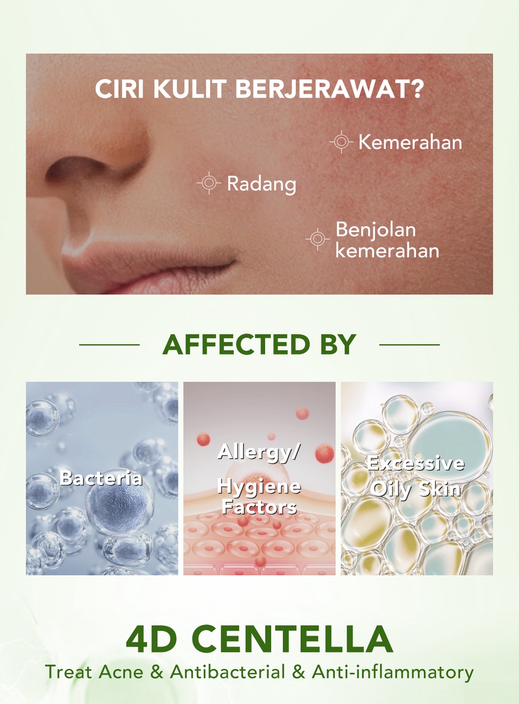 Jual YOU 3-in-1 Acne Treatment Bundle | Anti Acne Facial Wash, Acneplus ...