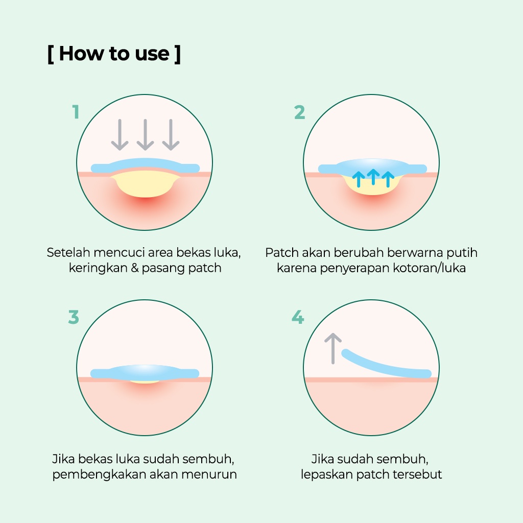 Jual SOME BY MI 30 Days Miracle Clear Spot Patch / Pimple Patch ...